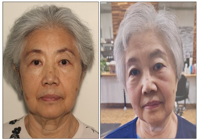 Gwinnett County Police seeks elderly missing woman requiring 24-hour ...